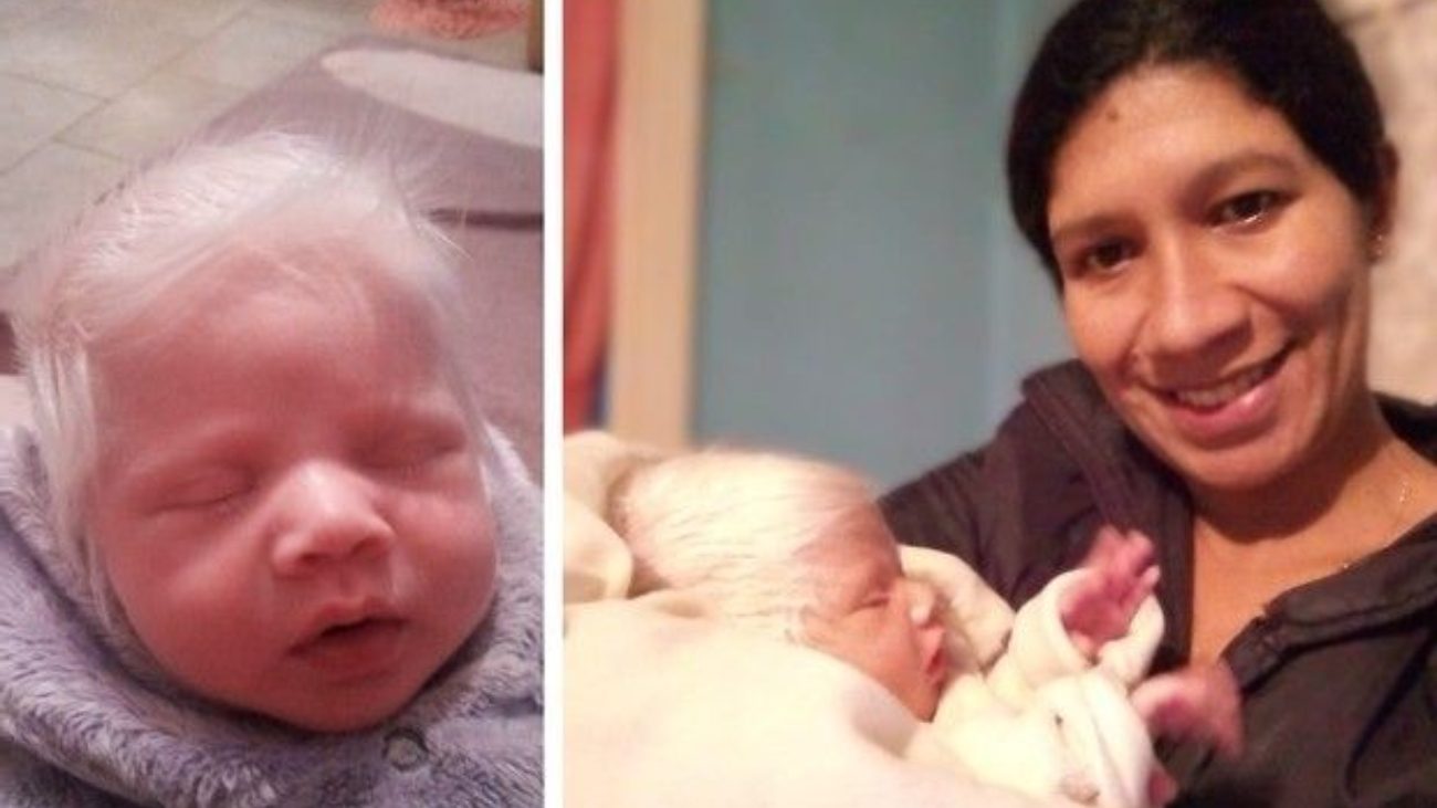 Bebê surpreende ao nascer com cabelo platinado e encanta família ...