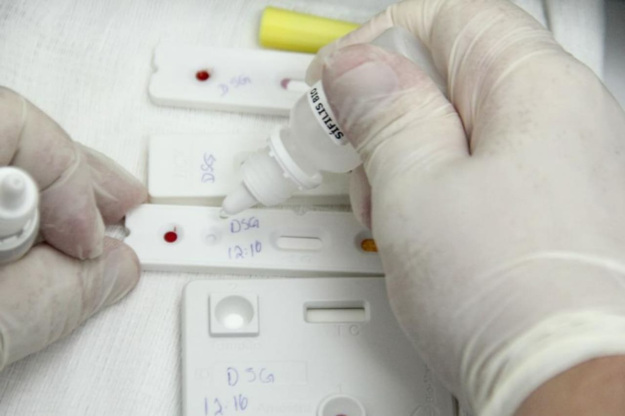 População Pode Fazer Teste Rápido De Hiv E Sífilis Em Barueri Neste